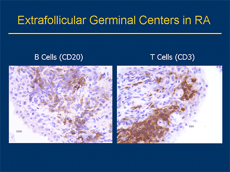 B-Cell Targeted Therapies: From Theory to Practice