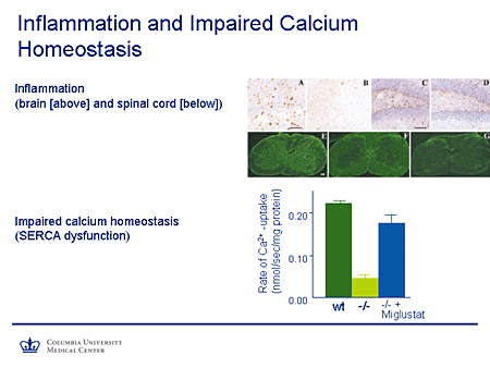 Small Molecule Inhibition for Gaucher Disease: Emerging Role of ...