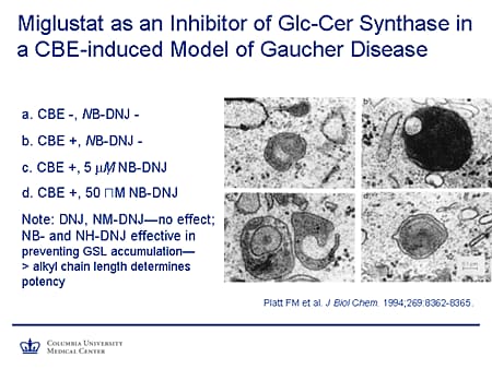 Small Molecule Inhibition for Gaucher Disease: Emerging Role of ...