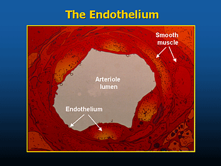 Improving Cardiovascular Outcomes: LDL and Beyond