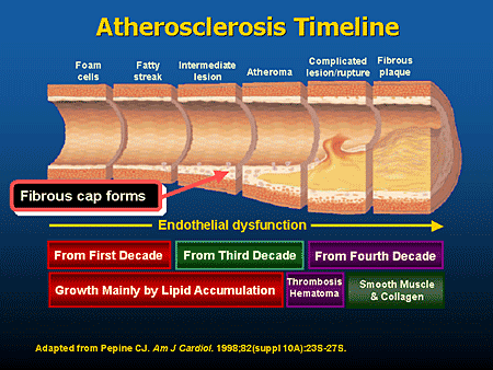 Improving Cardiovascular Outcomes: LDL and Beyond