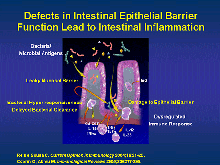 Advances in the Treatment of Crohn's Disease: From Research to Clinical ...