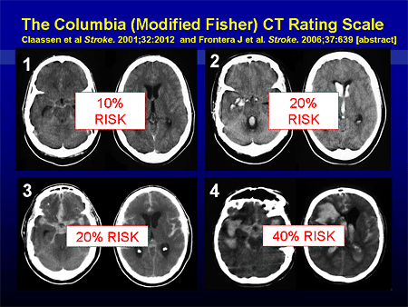 Debating Hypertensive Management Approaches in Acute Hemorrhagic and ...