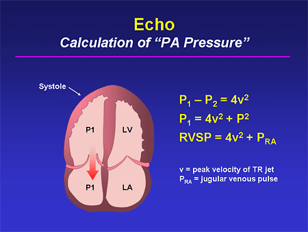 Lessons From Heart Failure for Pulmonary Arterial Hypertension (PAH)