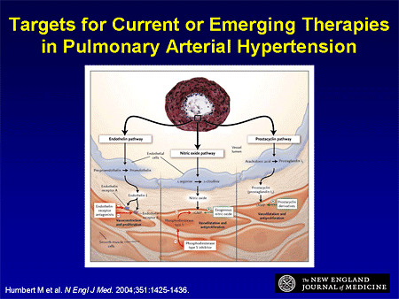 Lessons From Heart Failure for Pulmonary Arterial Hypertension (PAH)