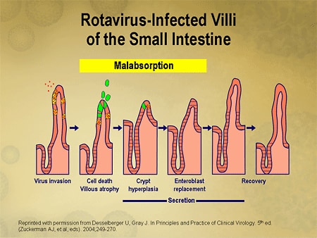What's on the Horizon? Understanding the Disease Burden and Rising to ...