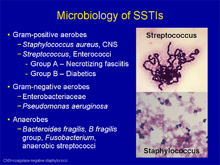 Healthcare-Associated and Community-Acquired MRSA