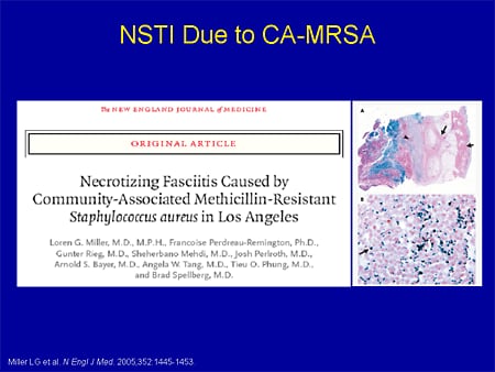Healthcare-Associated and Community-Acquired MRSA