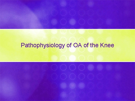 Integrating Viscosupplementation Into a Comprehensive Osteoarthritis Treatm