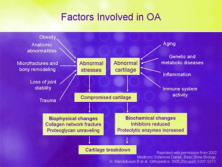 Integrating Viscosupplementation Into a Comprehensive Osteoarthritis Treatm