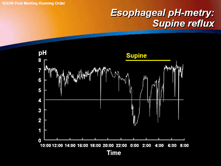 Nocturnal Gastroesophageal Reflux Disease