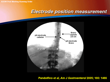 Nocturnal Gastroesophageal Reflux Disease