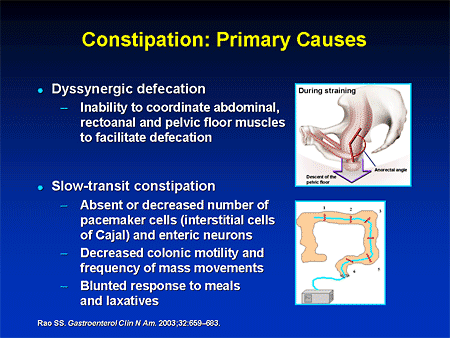 Raising the Bar in the Management of Chronic Idiopathic Constipation