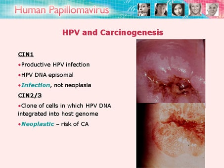 Different Perspectives: Case Studies in HPV Management