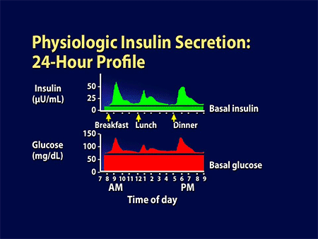Insulin-Treated Type 2 Diabetes: Balancing Physiologic and Individual Needs