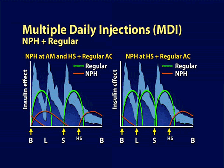 Insulin-Treated Type 2 Diabetes: Balancing Physiologic and Individual Needs