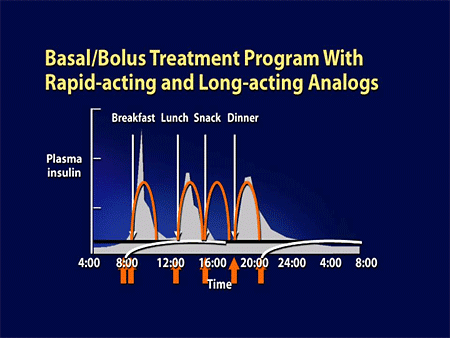 Insulin-Treated Type 2 Diabetes: Balancing Physiologic and Individual Needs