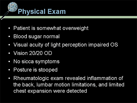 Multiple Sclerosis Treatment: Diagnosis and Disease Management