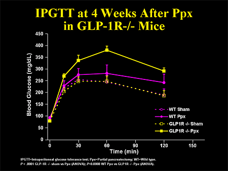 Resurrecting the Beta Cell in Type 2 Diabetes