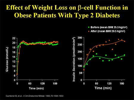 Resurrecting the Beta Cell in Type 2 Diabetes