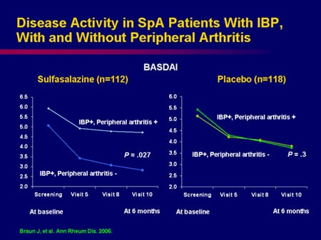 Refining the Focus: A New Look at Spondylitis