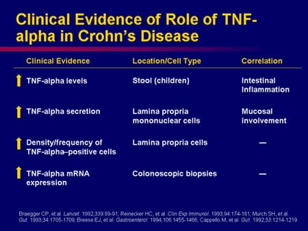 Refining the Focus: A New Look at Spondylitis