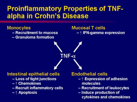 Refining the Focus: A New Look at Spondylitis