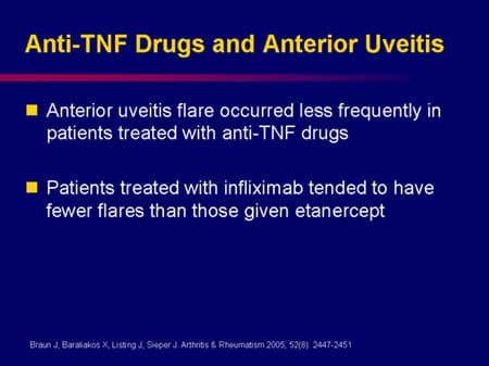 Refining the Focus: A New Look at Spondylitis