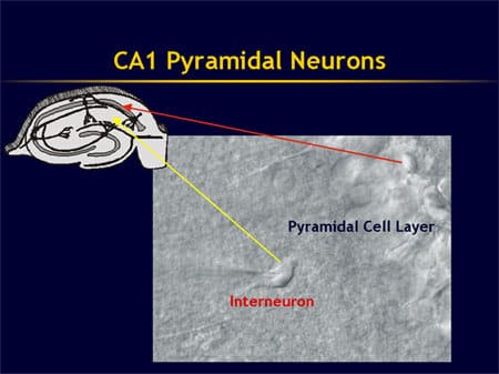 Navigating Neuronal Pathways: Novel Targets for the Management of Sleep ...