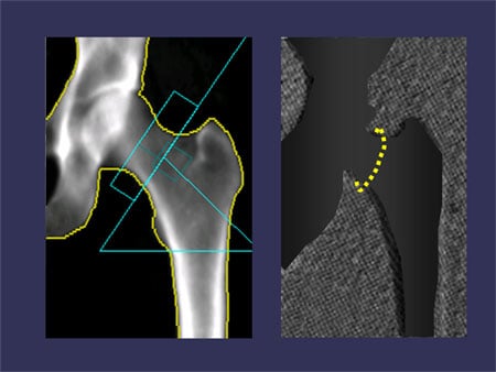 Modern Advances in the Understanding of Bone Structure