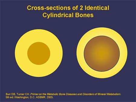 Modern Advances in the Understanding of Bone Structure