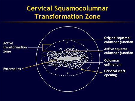 Preventing STD-Related Cancers: An Update on Vaccination Strategies