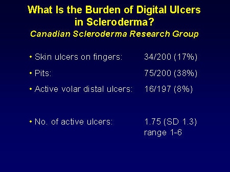 Vascular Complications of Systemic Sclerosis