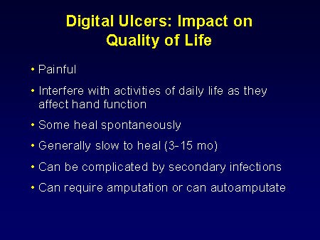 Vascular Complications of Systemic Sclerosis