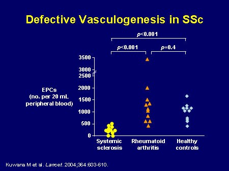 Vascular Complications of Systemic Sclerosis
