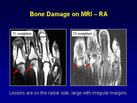 Changing the Treatment of Rheumatic Diseases: Optimal Use of Biologic ...