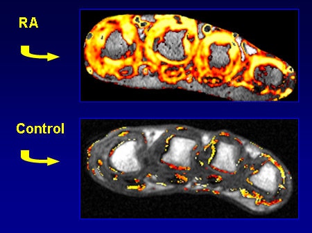 Changing the Treatment of Rheumatic Diseases: Optimal Use of Biologic ...