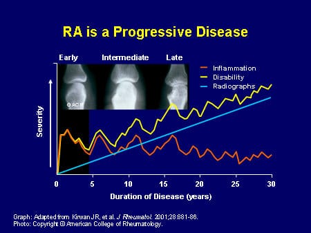 Changing the Treatment of Rheumatic Diseases: Optimal Use of Biologic ...