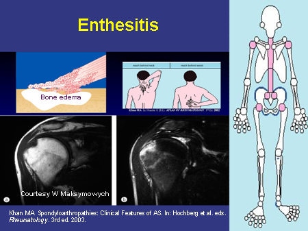 Changing the Treatment of Rheumatic Diseases: Optimal Use of Biologic ...