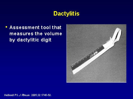 Changing the Treatment of Rheumatic Diseases: Optimal Use of Biologic ...