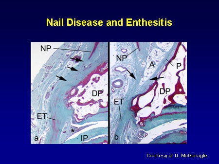 Changing the Treatment of Rheumatic Diseases: Optimal Use of Biologic ...