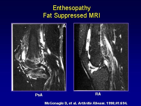 Changing the Treatment of Rheumatic Diseases: Optimal Use of Biologic ...
