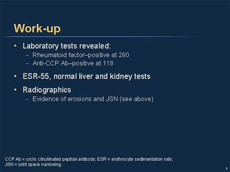 Improving Outcomes in RA: When Is It Time to Start Using Biologic Agents?
