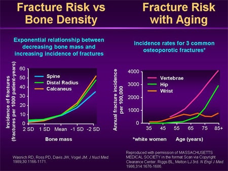 Current Concepts in Osteoporosis