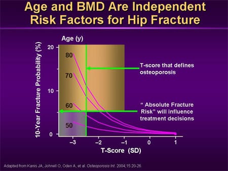 Current Concepts in Osteoporosis