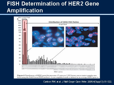 NCCN Breast Cancer Guidelines Update (Slides with Transcript)
