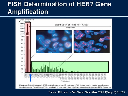 NCCN Breast Cancer Guidelines Update (Slides with Transcript)