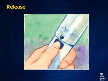 Inhaled Insulin: Pulmonary Considerations (Slides with Transcript)