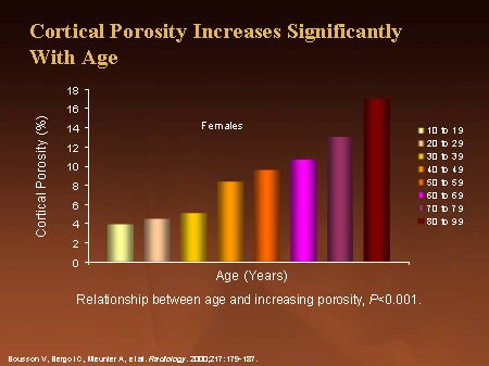 Qualities of Bone and the Effects of Treatment (Slides with Transcript)