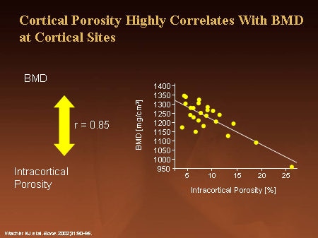 Qualities of Bone and the Effects of Treatment (Slides with Transcript)